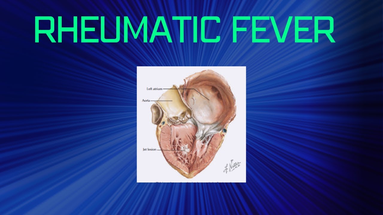 Overview : Rheumatic Fever - YouTube