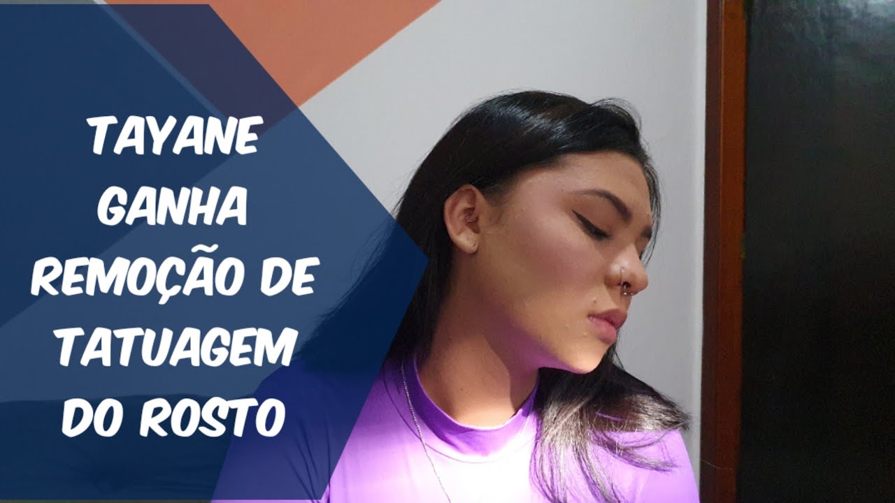 TAYANE CALDAS GANHA REMOÇÃO DE TATUAGEM NO ROSTO - YouTube