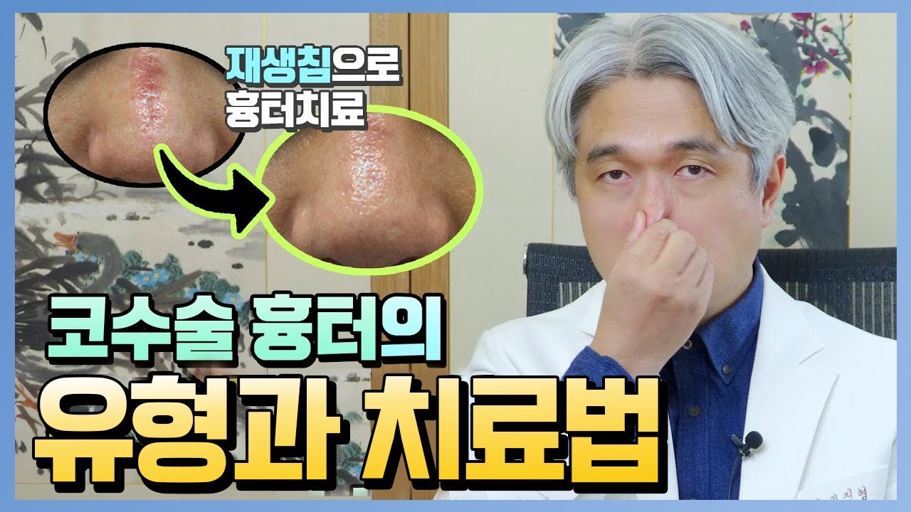 성형과 관상 코👃 코성형 흉터 코 필러 부작용의 유형과 한방치료ㅣ코수술부작용 명옥헌 한의원 Youtube