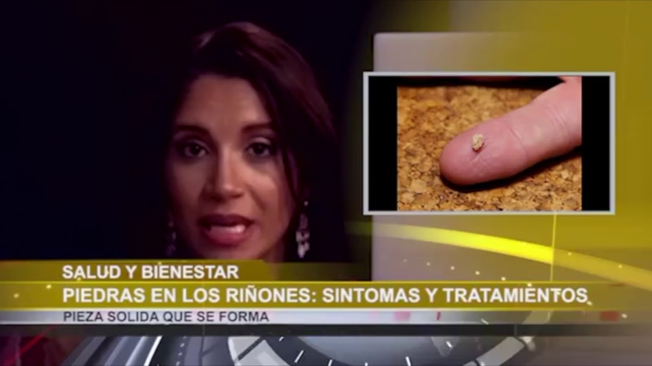 Dra Esther Pichardo - Piedra en los Riñones - YouTube