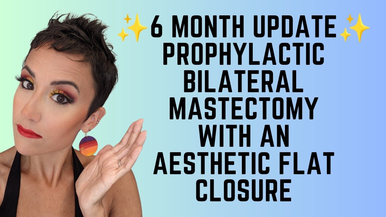 6 Month Mastectomy Update Double Bilateral Mastectomy Doctors ...