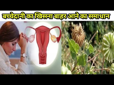 बच्चेदानी बाहर आने की समस्या का समाधान | uterus bahar nikalne ka ilaj ...