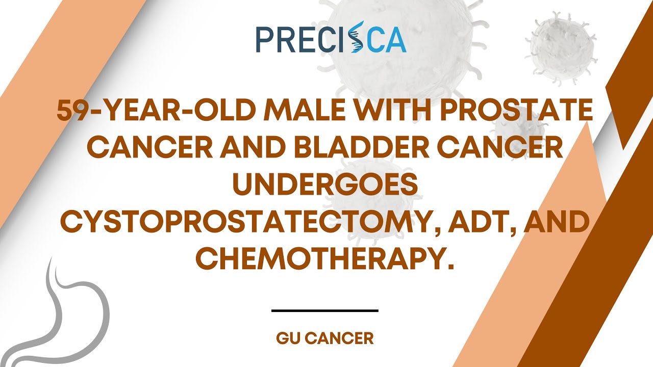 Expert Cancer Panel: Prostate and bladder cancer s/p cystoprostatectomy ...