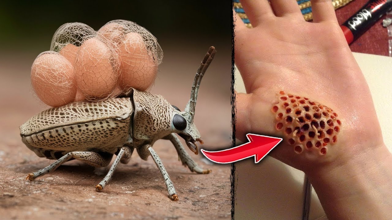 Most Dangerous Insects In The World! - YouTube