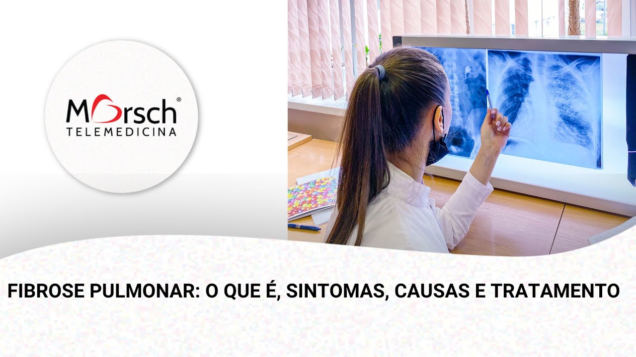 FIBROSE PULMONAR: O QUE É, SINTOMAS, CAUSAS E TRATAMENTO - YouTube