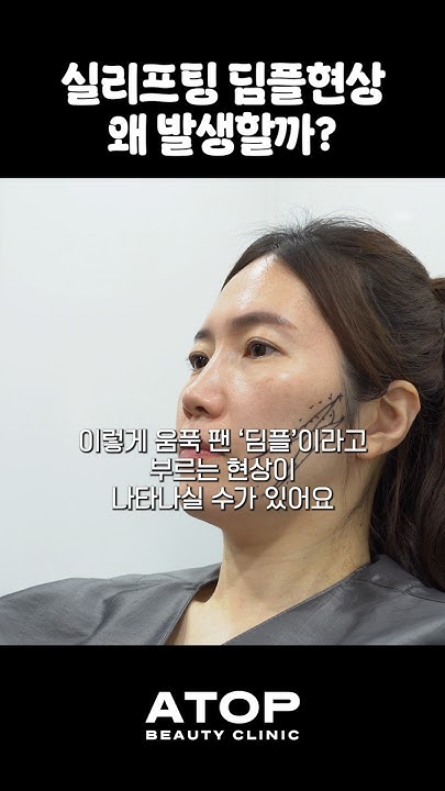실리프팅 딤플 왜 발생할까 실리프팅 딤플 리프팅 리프팅효과 실리프팅효과 실리프팅부작용 Youtube