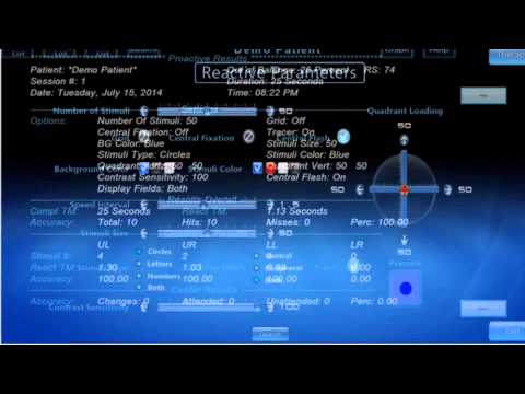 Sanet Vision Integrator and Balance - YouTube