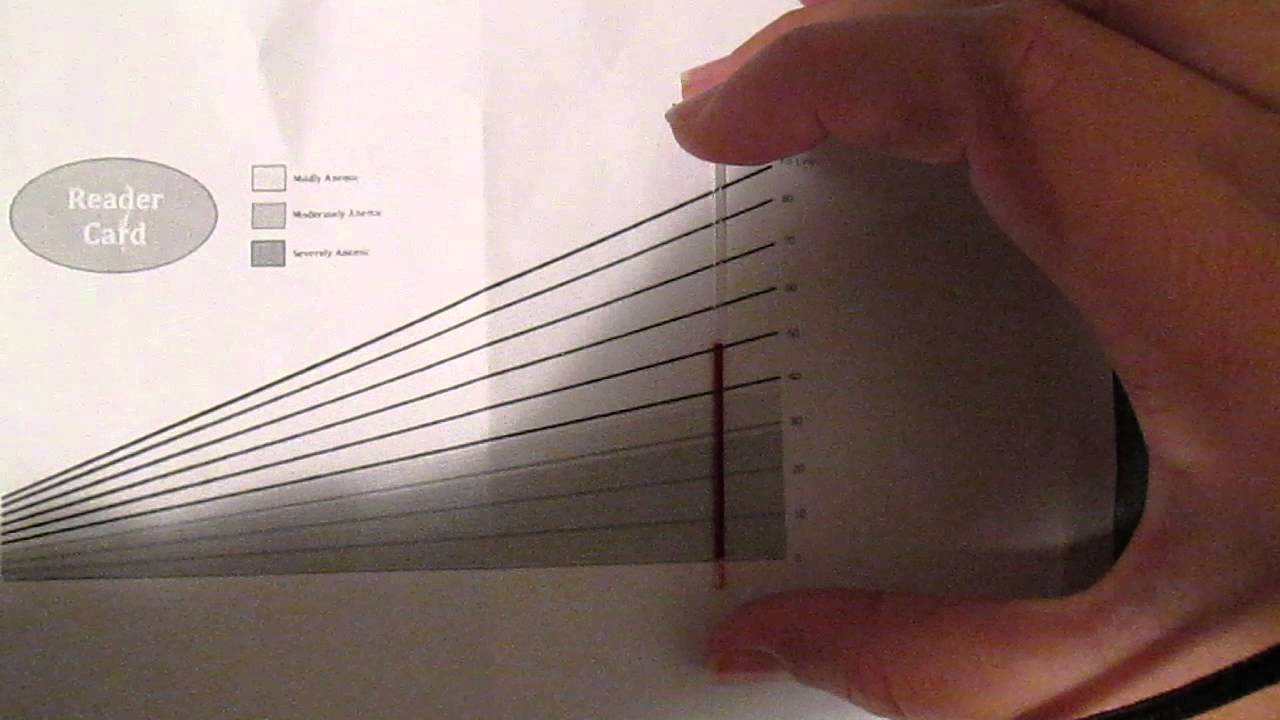 PCV Reading - YouTube