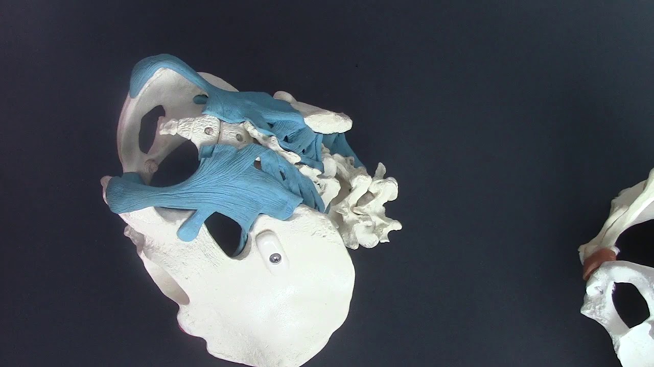 Stuck Hypomobile Sacroiliac from a Fall onto the Sit Bones - YouTube