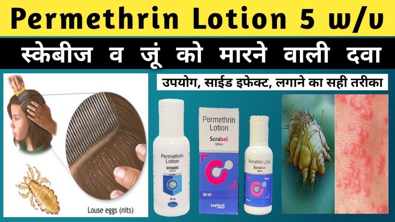 Permethrin Cream | Permethrin Lotion | Anti scabies Lotion | Permethrin ...