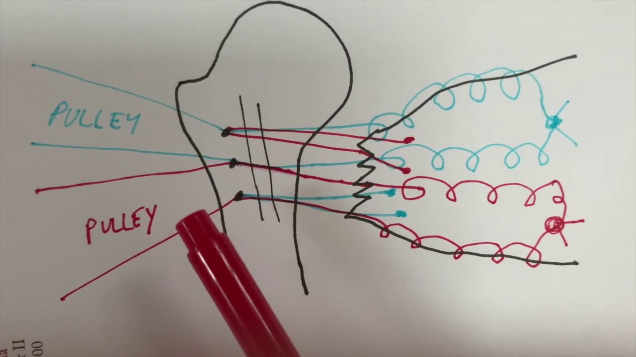 pec repair video - YouTube