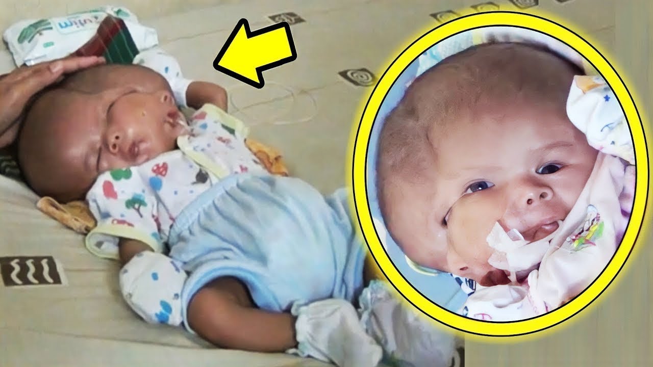 Baby born with TWO FACES, HER parents decided to do this! - YouTube
