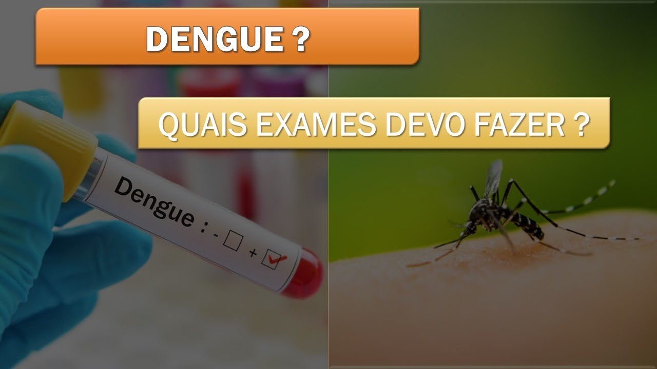 Dengue- Testes Laboratoriais, Testes Rápidos, IgG , IgM , NS1, RT-PCR ...
