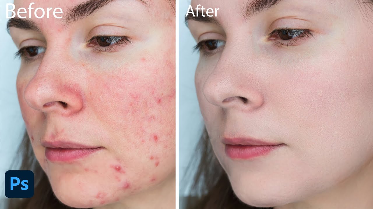 3 Easy Steps For High End Skin Retouch In Photoshop Skin Retouching