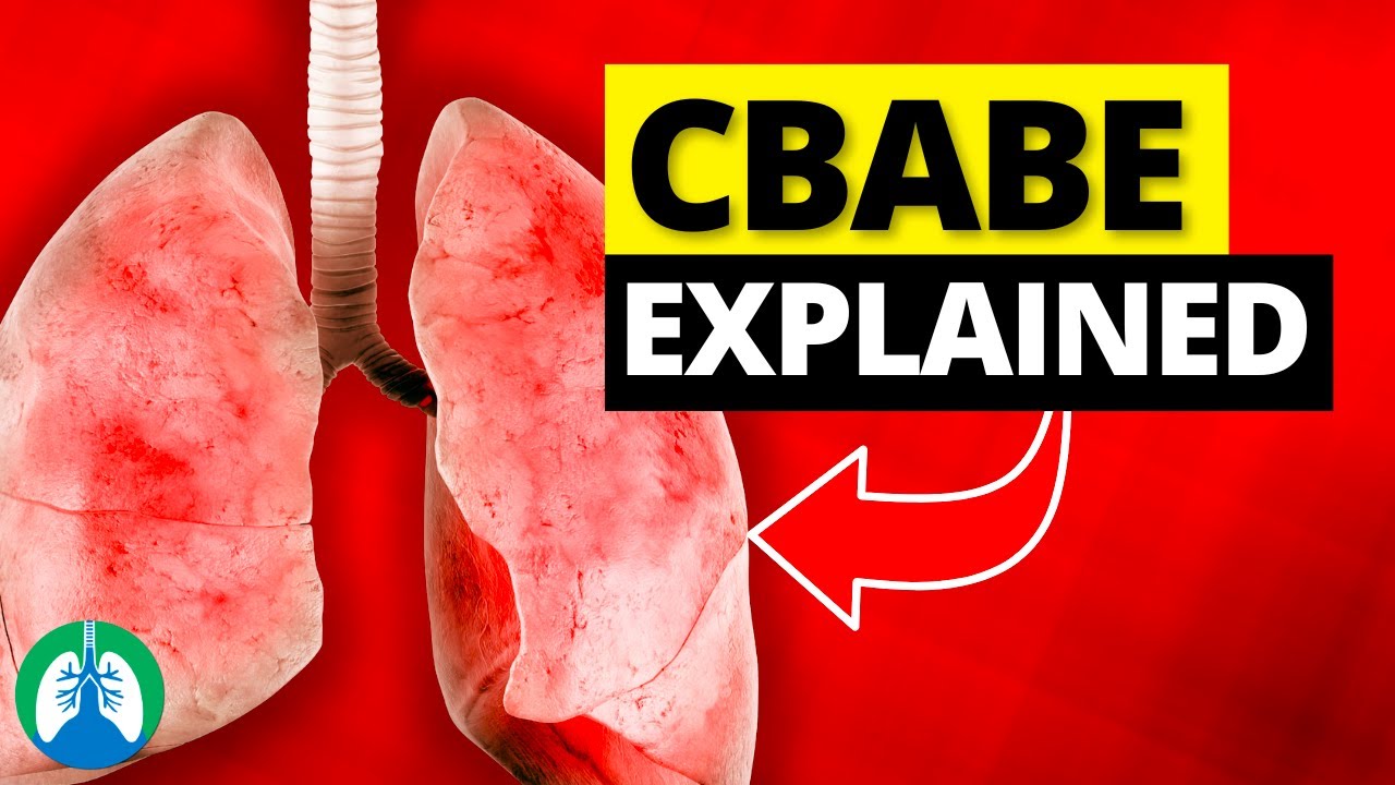 CBABE Explained: Top 5 Obstructive Lung Diseases - YouTube