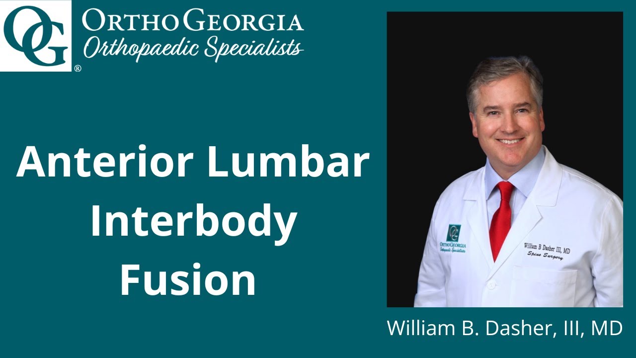 What is Anterior Lumbar Interbody Fusion? - Dr. William Dasher - YouTube