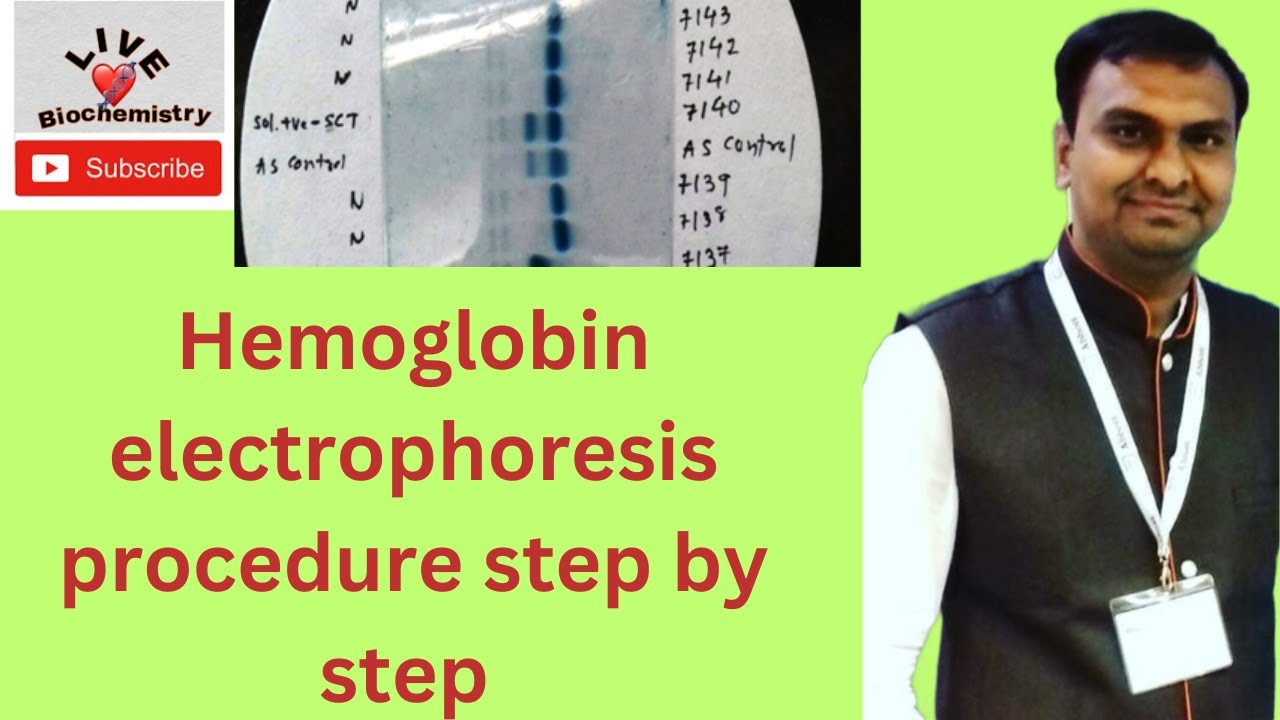 Hemoglobin Electrophoresis Procedure Agarose Gel Hemoglobin Electrophoresis For Sickle Cell