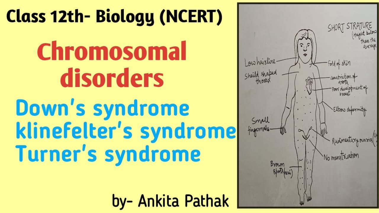 class -12 chromosomal disorders - YouTube