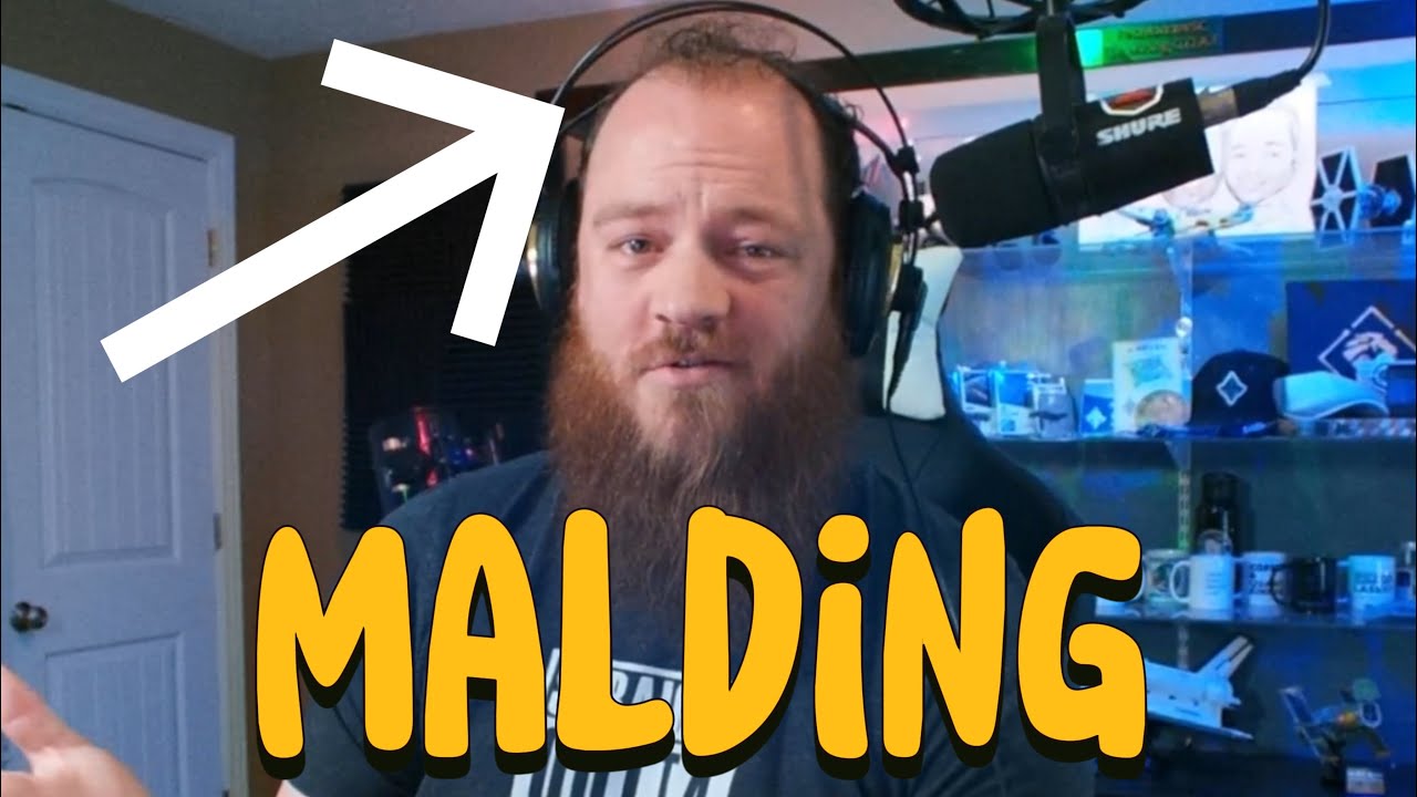 Balding Streamer Copes with Loss! ft. @RedMonsterSC - YouTube