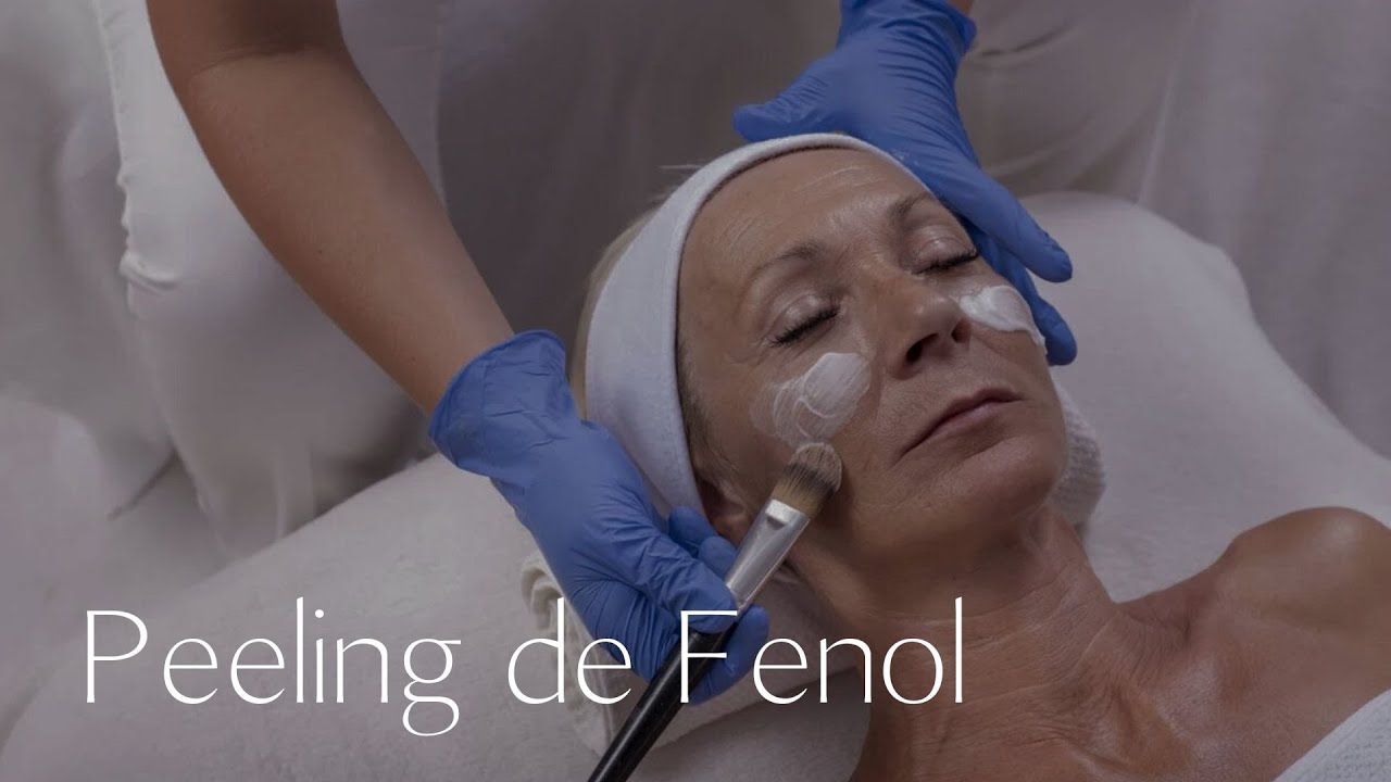 Peeling de Fenol - YouTube