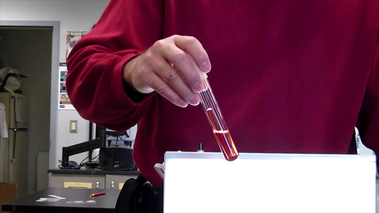 Analysis of lactose fermentation tubes - YouTube