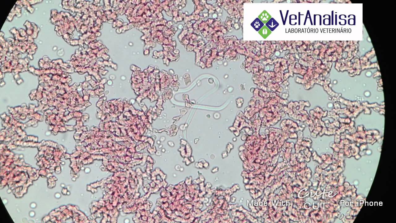 Microfilaria - YouTube