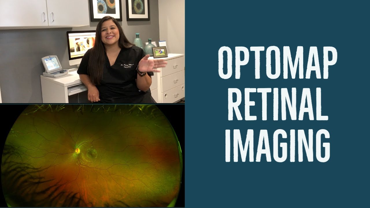 Retinal Optomap Imaging - YouTube