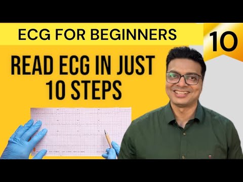 10 Easy steps of reading an ECG | Normal ECG | Writing the findings of ...