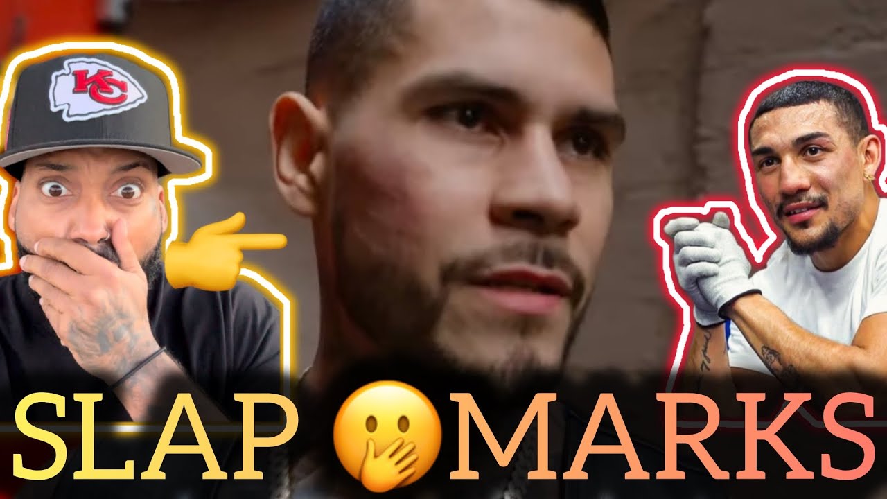 “Arnold Barboza Shows SMACK MARKS.” Teofimo Too Fast. - YouTube