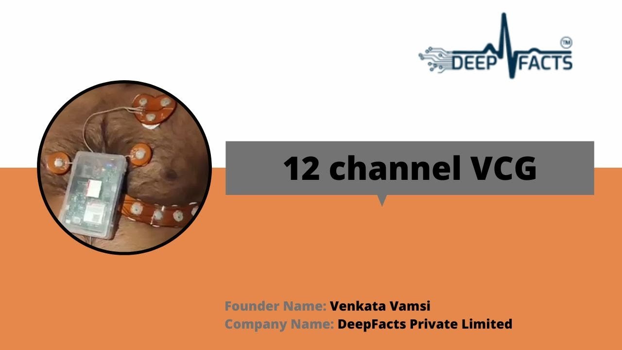 12 Channel VCG - YouTube