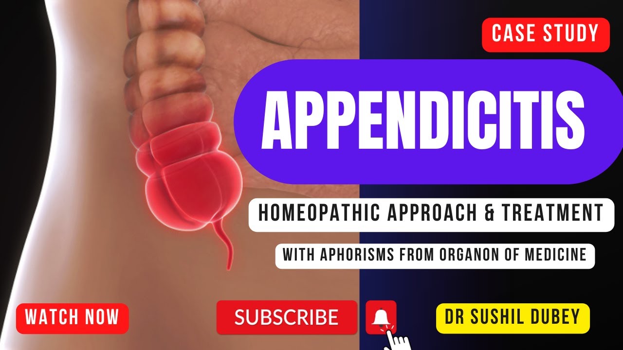 How Dr Sushil Dubey Cured Appendix Pain WITHOUT Surgery! - YouTube