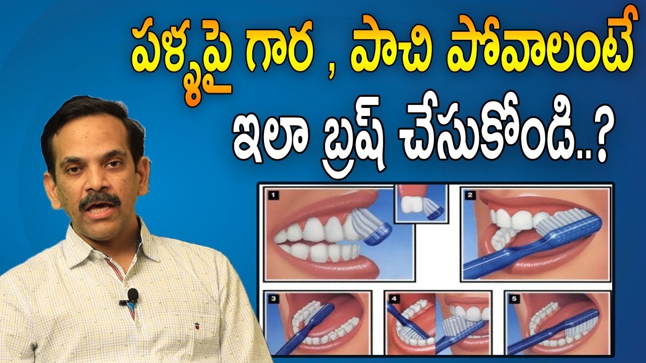 పళ్ళపై గార , పాచి పోవాలంటే ఇలా బ్రష్ చేసుకోండి..? | How to Brush your ...