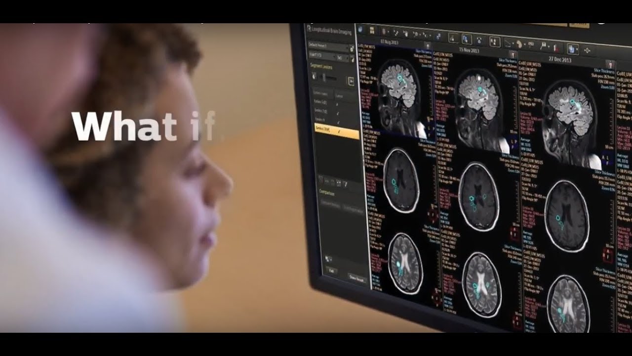 Philips IntelliSpace Portal 9.0 - All your advanced analysis needs, one ...