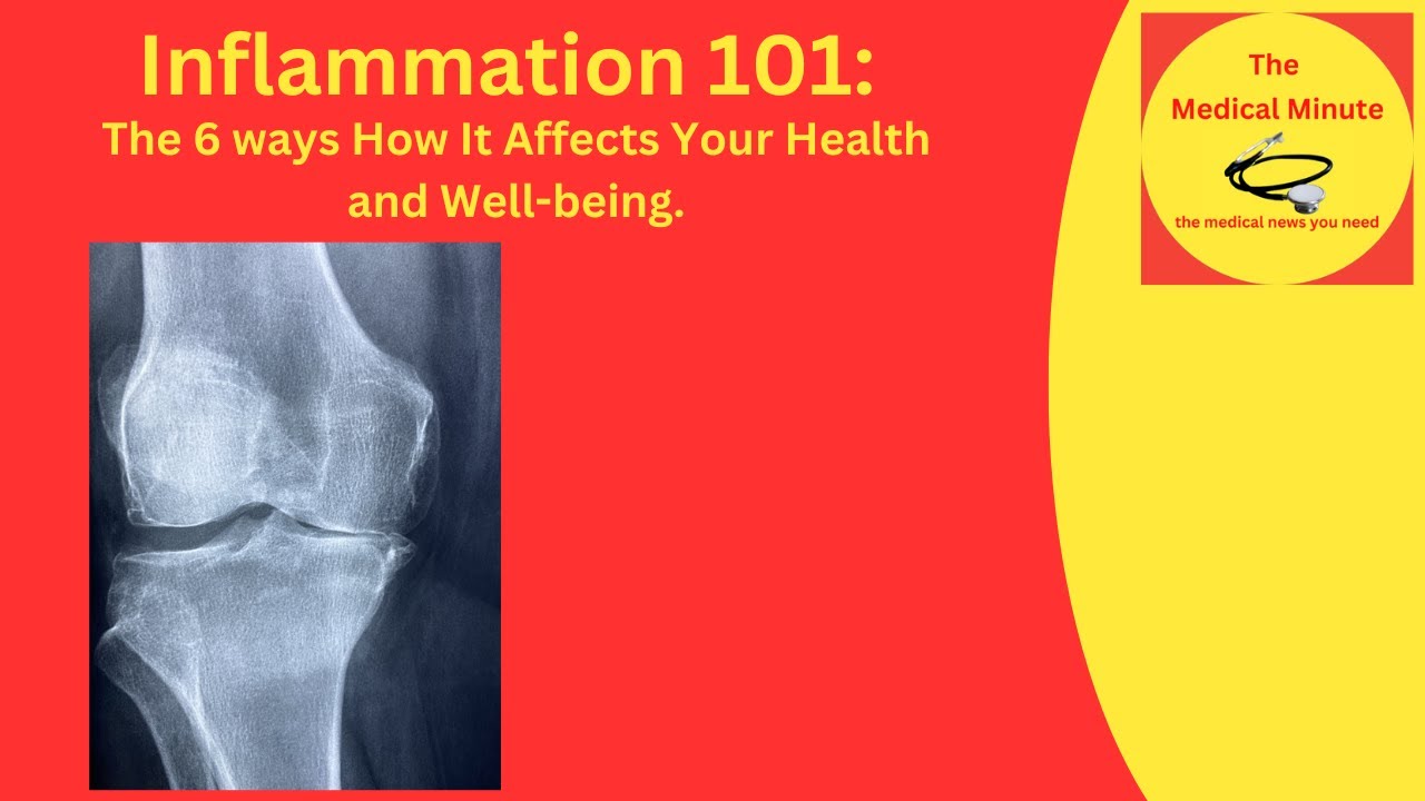Inflammation 101: The 6 ways How It Affects Your Health and Well-being ...