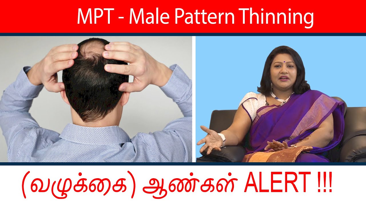 Baldness In Men | Reasons Behind Male Pattern Thinning| Dr. Praba Reddy ...
