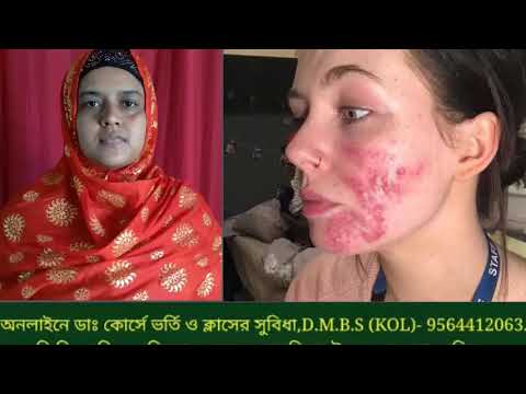 ADEL - 12 ঔষধটির প্রয়োজনিয়তা সম্পর্কে বিস্তারিত জানুন। ডাঃনারগিস ...
