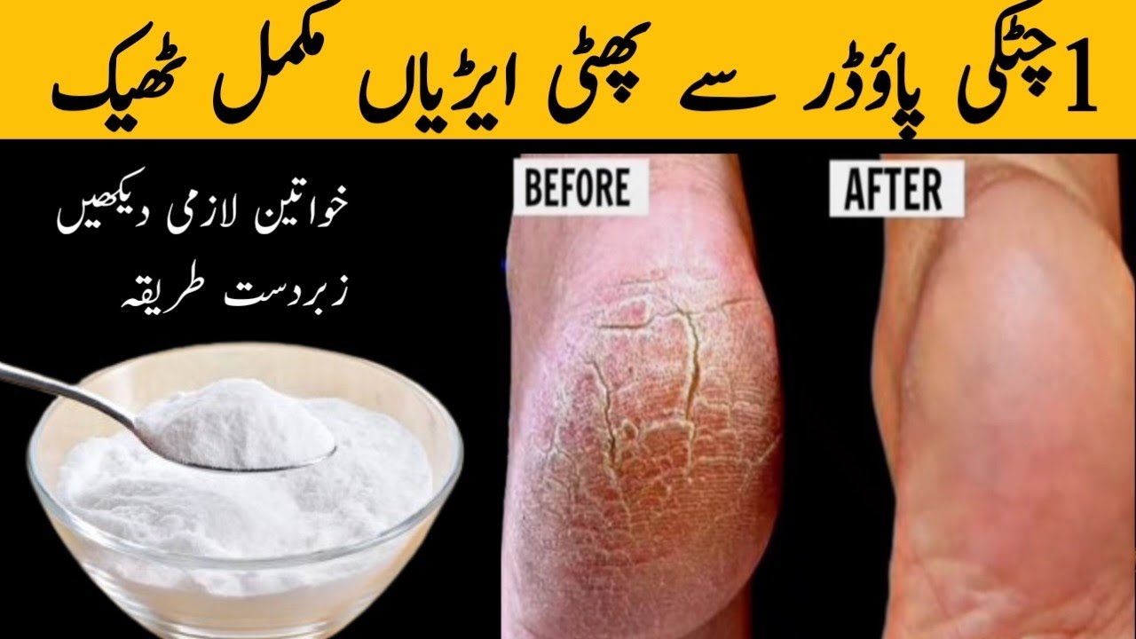 Hand and feet repair cream || DIY hand and feet bleach || Hand ...