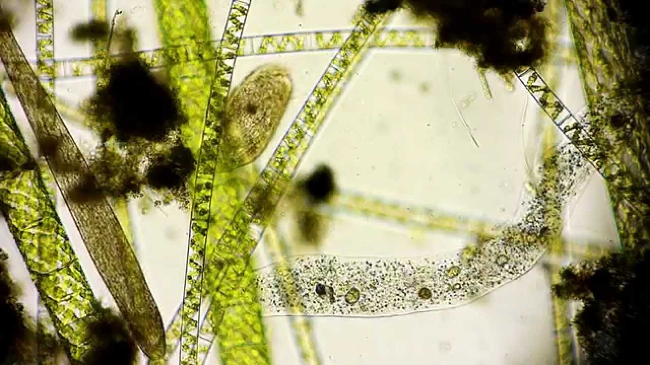 🔬 Amöbe - Wechseltierchen - amoeba limax - Leben im Wassertropfen ...