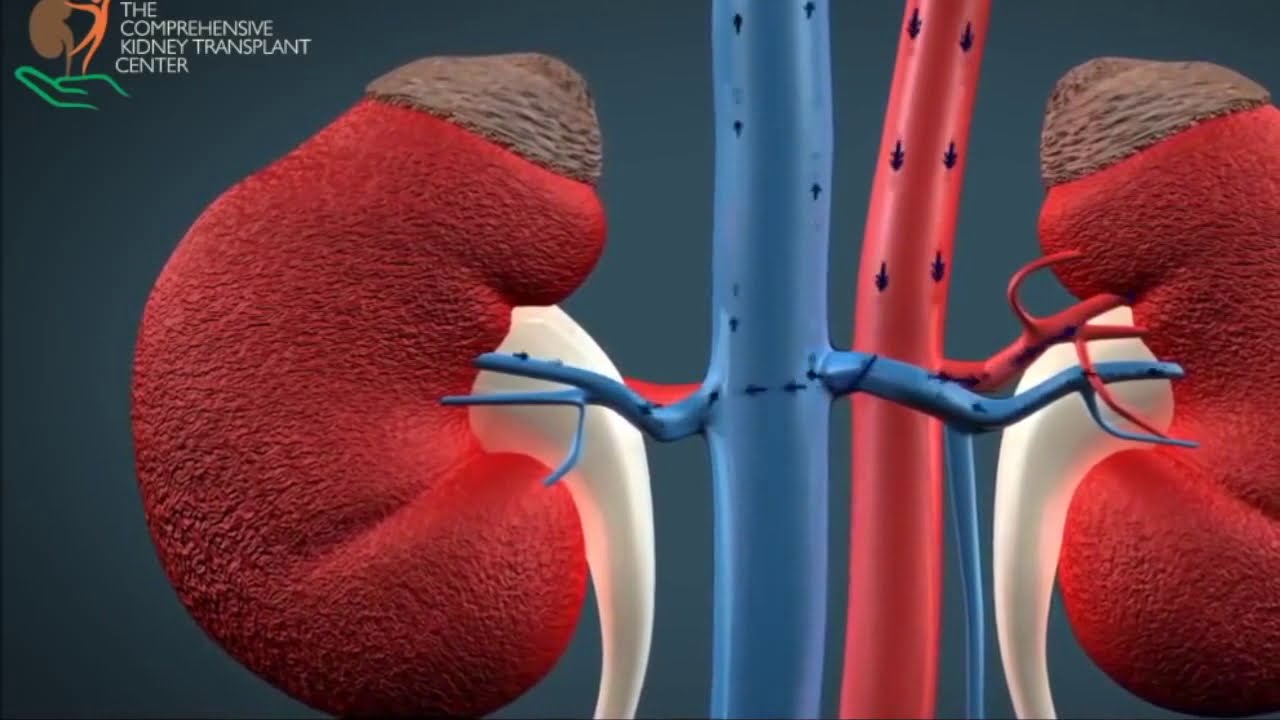 Kidney Transplant Surgery Explained YouTube kidney-transplant-surgery-explained-youtube