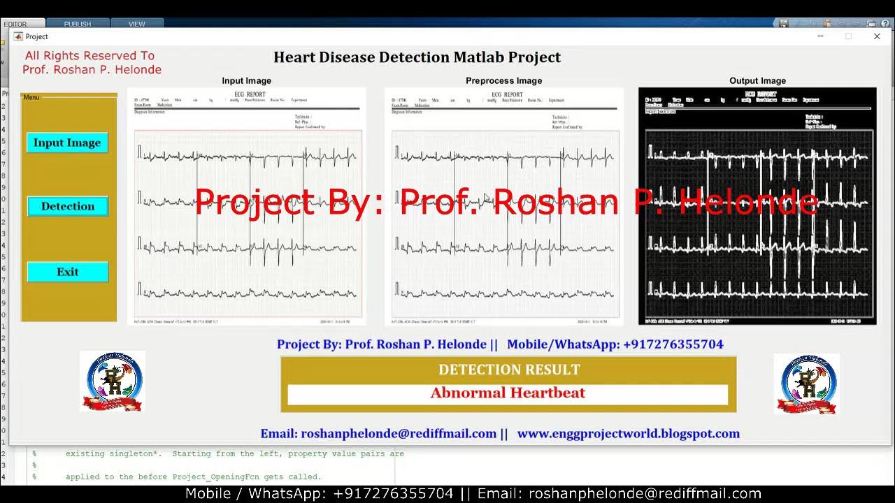 Heart Disease Detection Using Matlab | Heart Disease Detection Using Image Processing Final ...