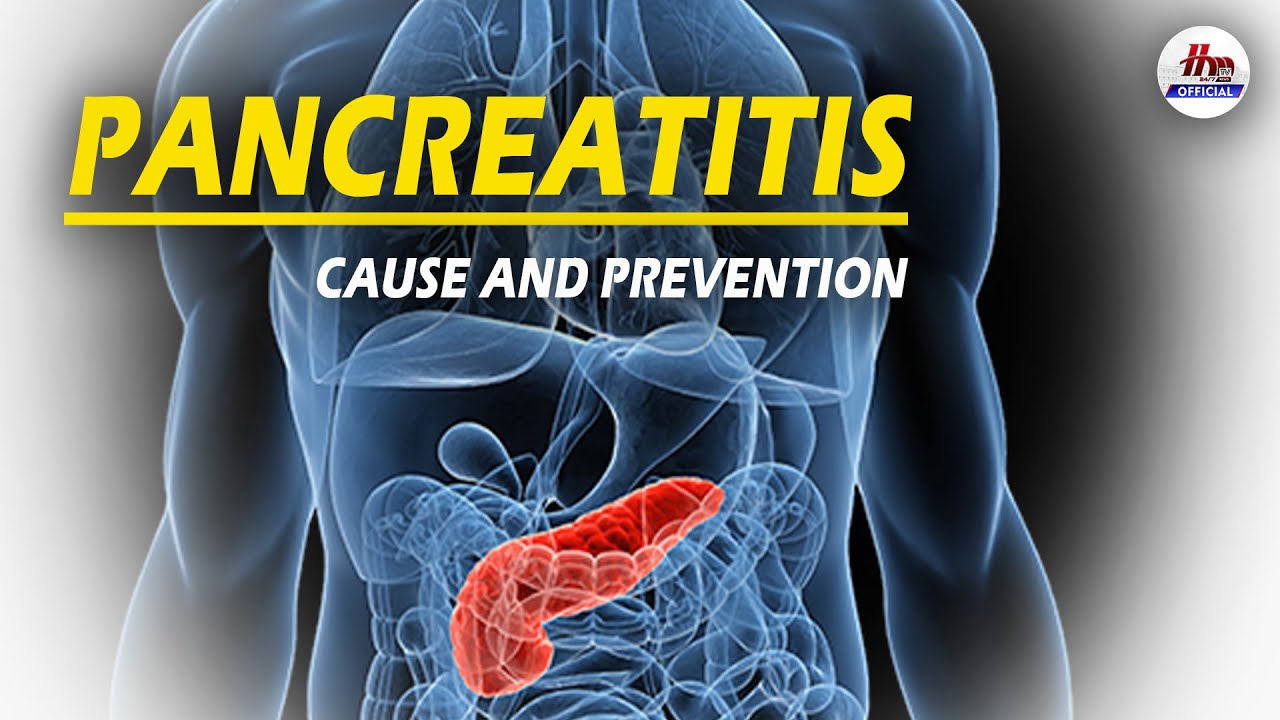 Pancreatitis || Cause and Prevention || HMTV Official - YouTube