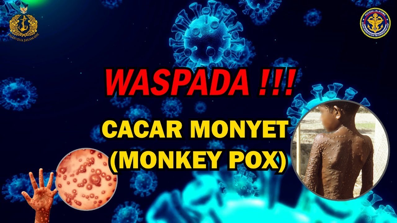 WASPADA CACAR MONYET (MONKEY POX) - YouTube