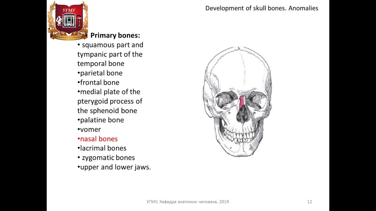 Development of skull bones. Anomalies - YouTube
