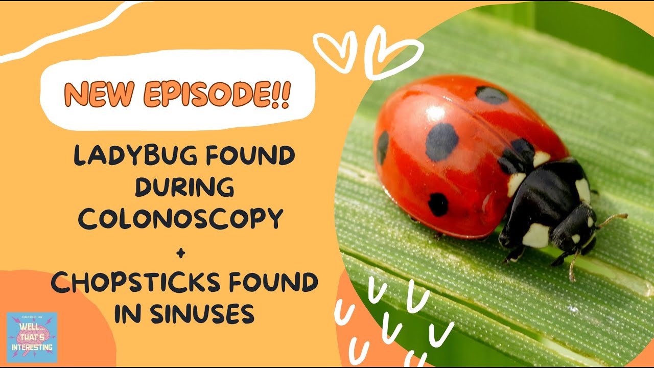 In-Betweeni 048: Ladybug Found During Colonoscopy + Chopsticks Found In ...
