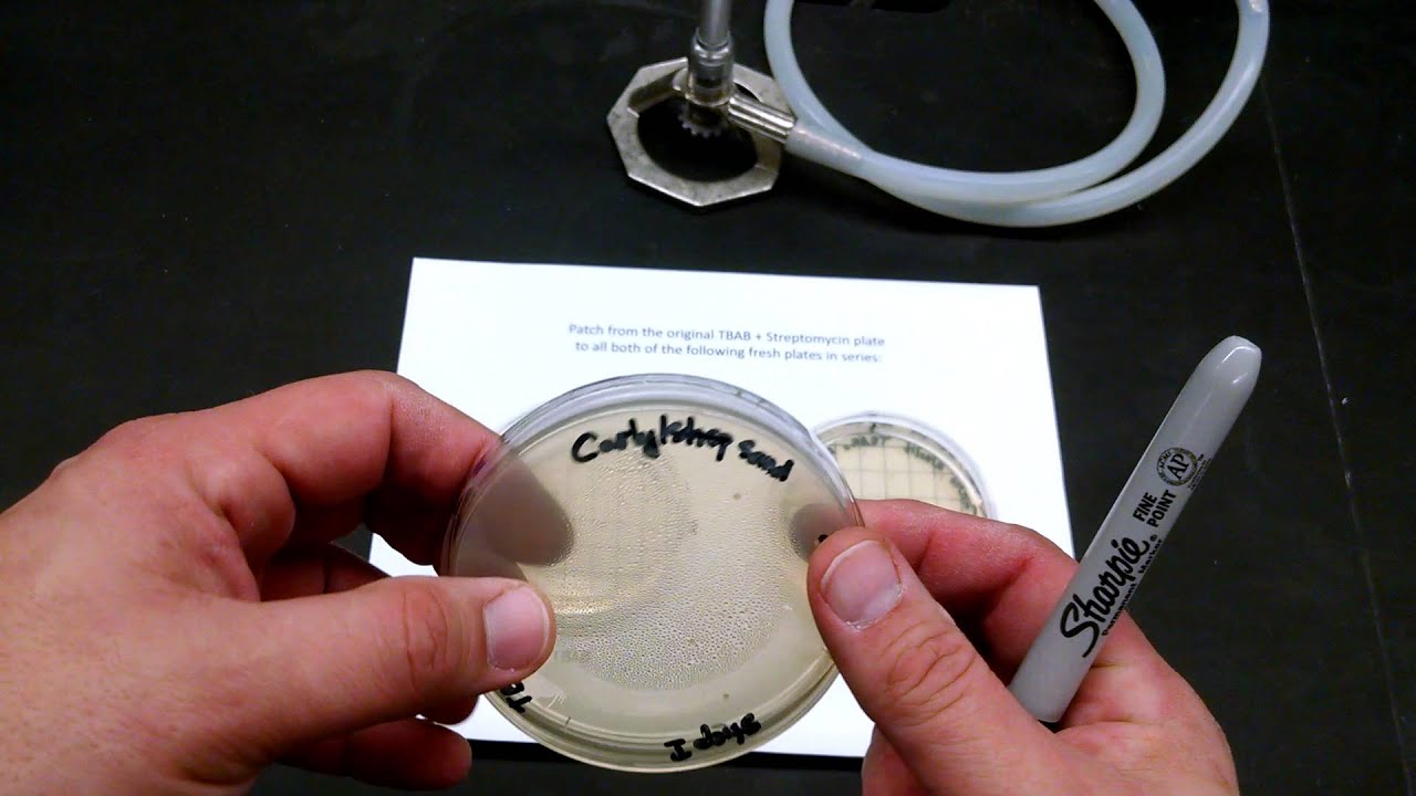 BIOL302L Patching Colonies - YouTube
