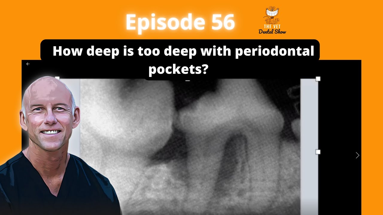 Ep 56 - How deep is too deep with periodontal pockets? - YouTube