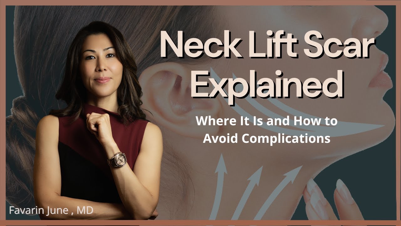 Neck Lift Scar Explained: Where It Is and How to Avoid Complications ...