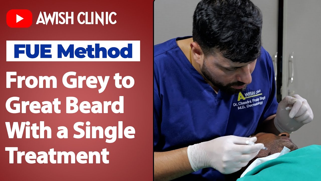 The Ultimate White Beard Transformation | White Beard Treatment | Awish ...