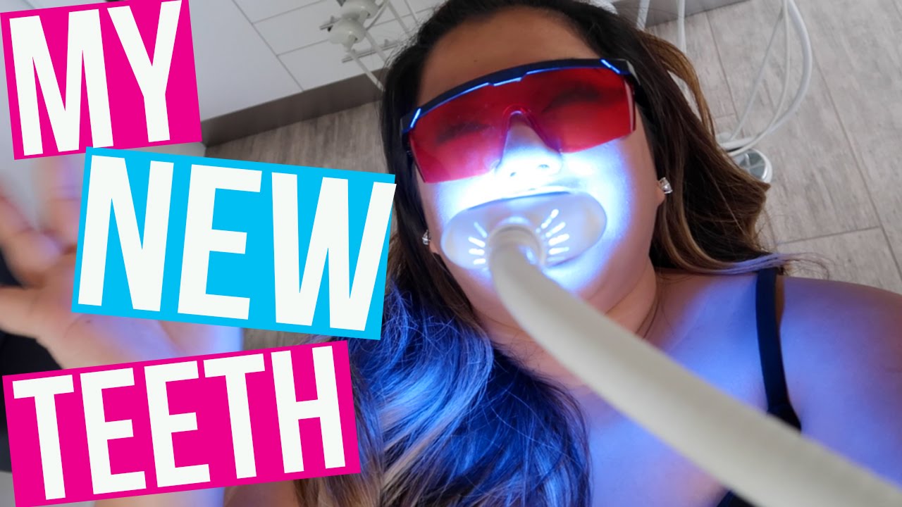 MY NEW TEETH!! - YouTube