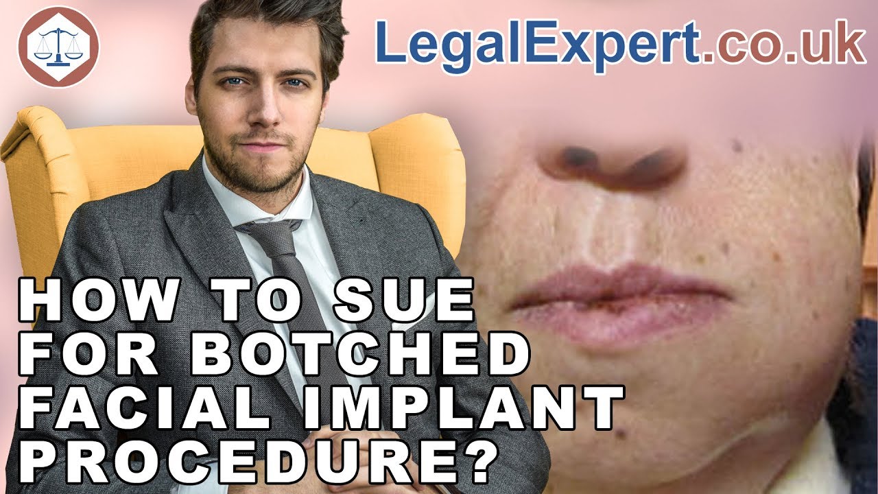 How to Sue for Botched Facial Implant Procedure ( 2019 ) UK - YouTube